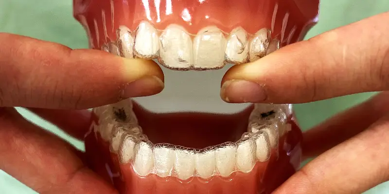 Ungenaue Passform von Alignern: Ursachen und Abhilfe